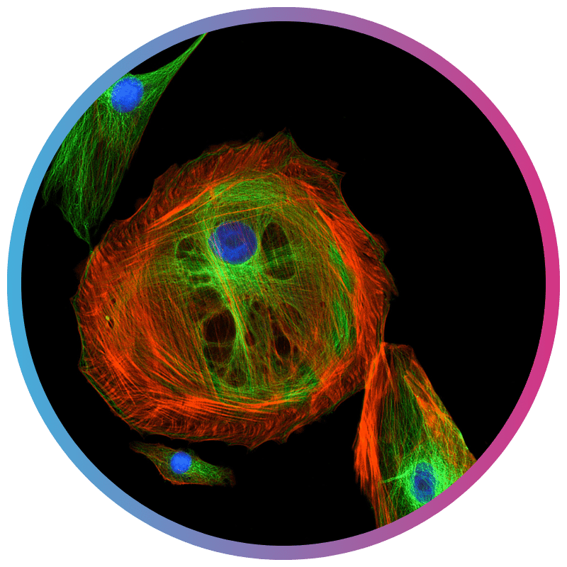 Single-Cell Data Annotation for Therapeutic Target Discovery | Excelra